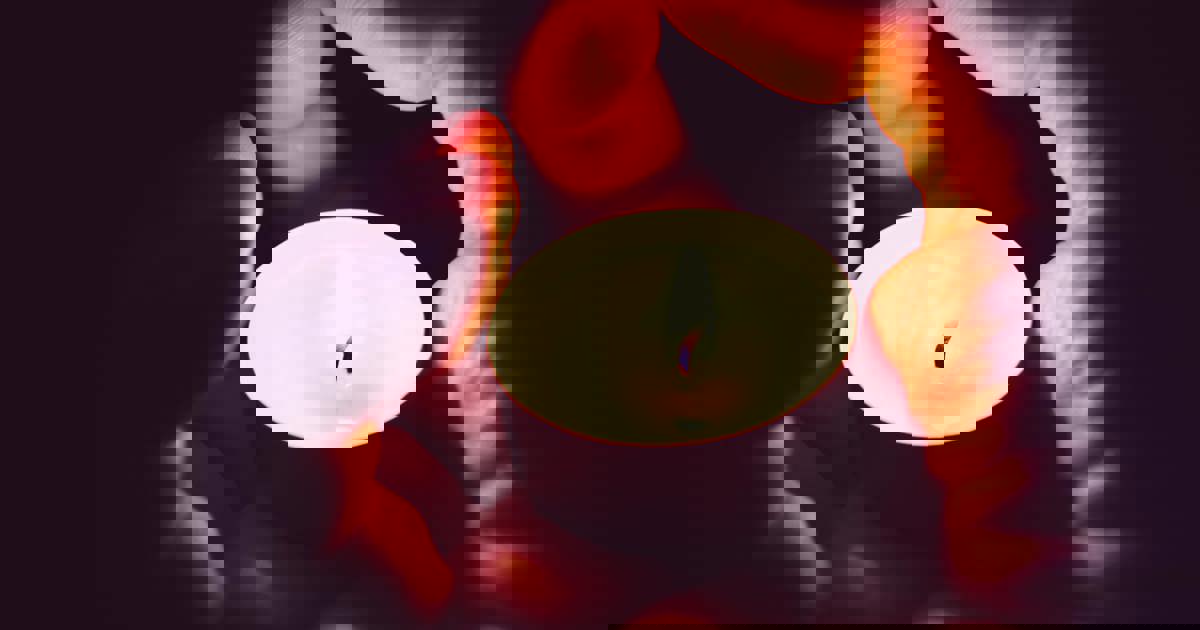 Eskom warns of load shedding risk