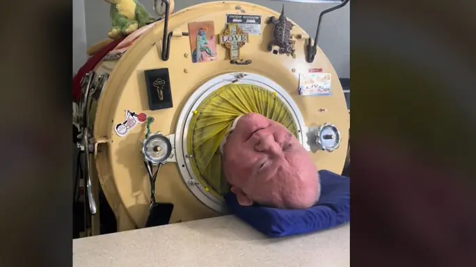 Paul Alexander, the 'man in the iron lung' and longest Polio survivor ...