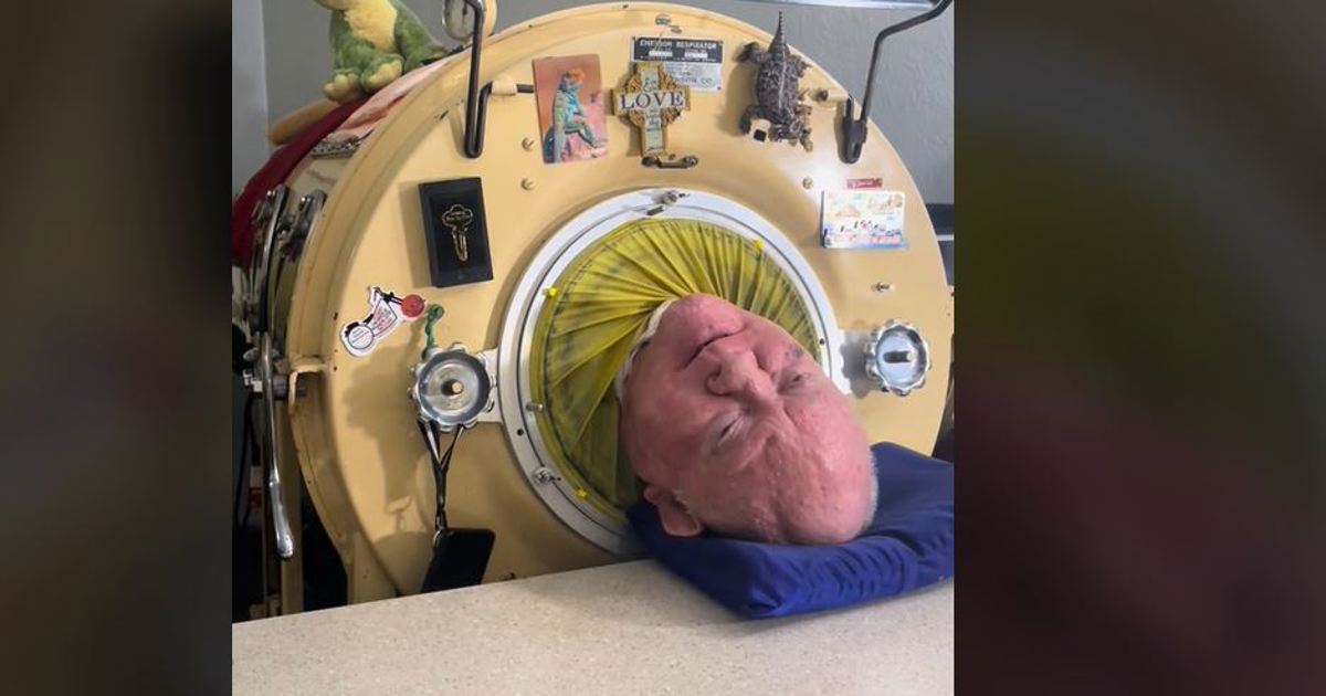 Paul Alexander, the 'man in the iron lung' and longest Polio survivor ...