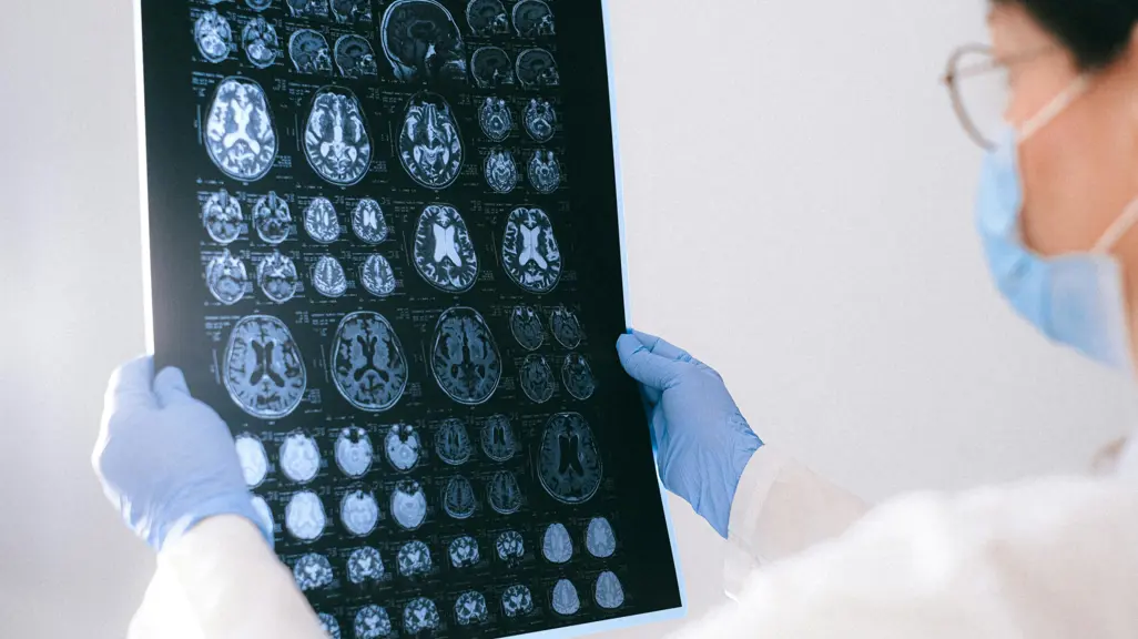 Study suggests being multilingual can slow brain ageing