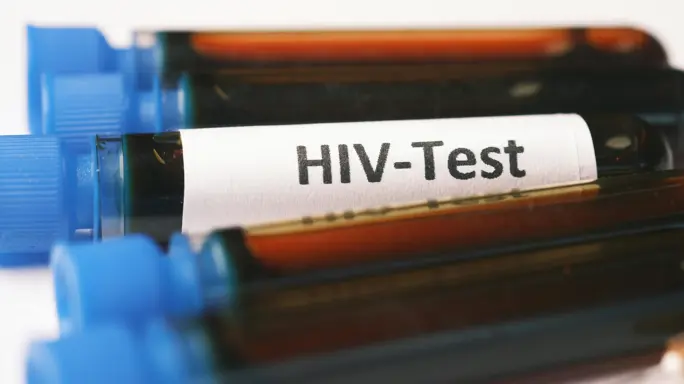 ARV uptake slows among HIV-positive South Africans, new data shows
